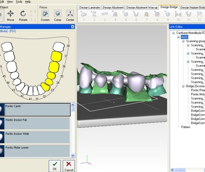 Технология Procera | Сеть стоматологических клиник Азбука Здоровья